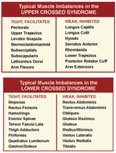 Should we add Upper & Lower Crossed Syndrome to the list of our ...
